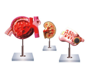 MODEL OF KIDNEY SETION,RENAL CORPUSCLE AND THE RENAL PODOCYTES ...